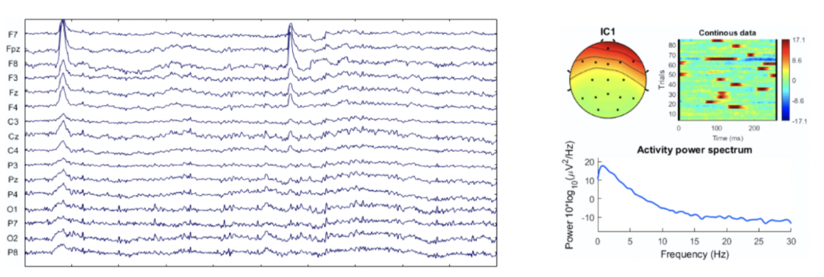 A SOTA EEG-based Emotional Recognition with viewing and auditory stimuli